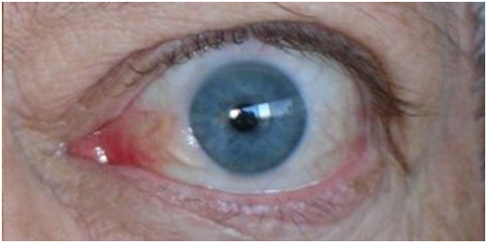 Conditions / Treatments – Eye Surgery Consultants